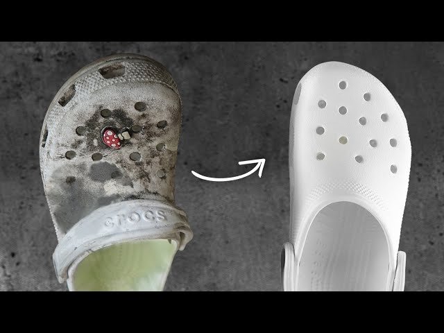 How to Clean Crocs White: Ultimate Guide for Sparkling Shoes