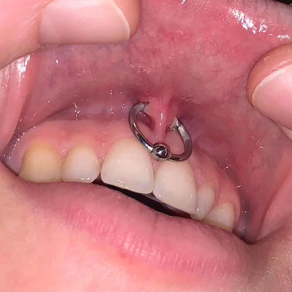 How to Clean Smiley Piercing: Expert Tips and Tricks